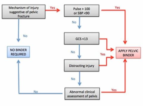 Bekkensling: wanneer aanleggen? - PreHospital Solutions